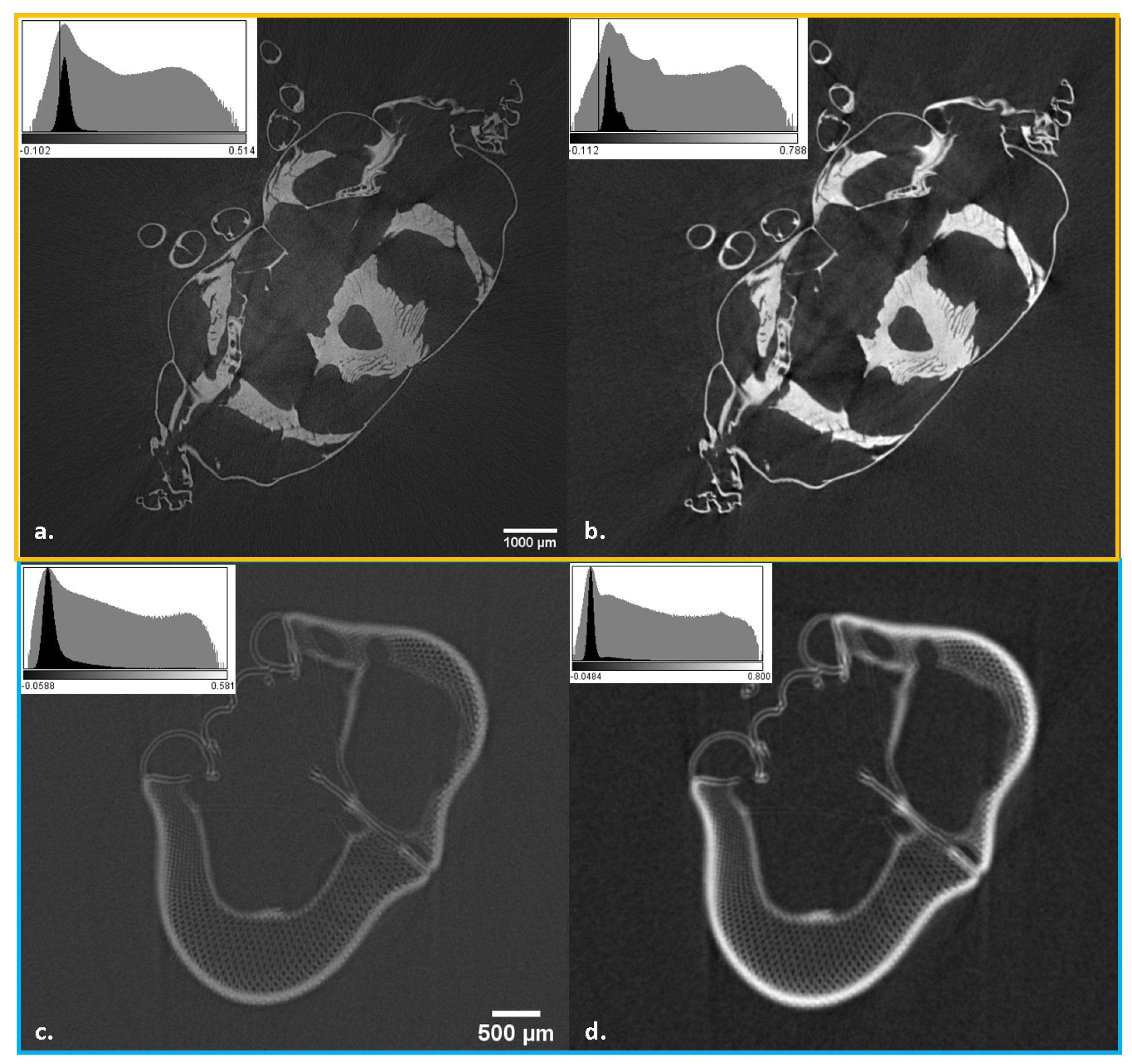 Cone Beam Ct Image Reconstruction The Best Picture Of Beam