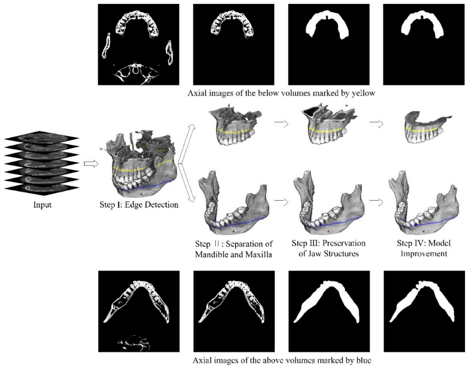 Applied Sciences Free Full Text Jawbone Segmentation With