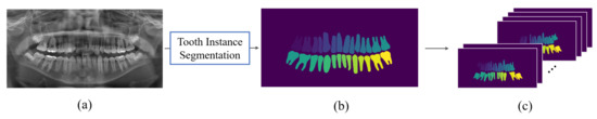 Deep Learning Based Detection of Missing Tooth Regions for Dental Implant Planning in Panoramic ...