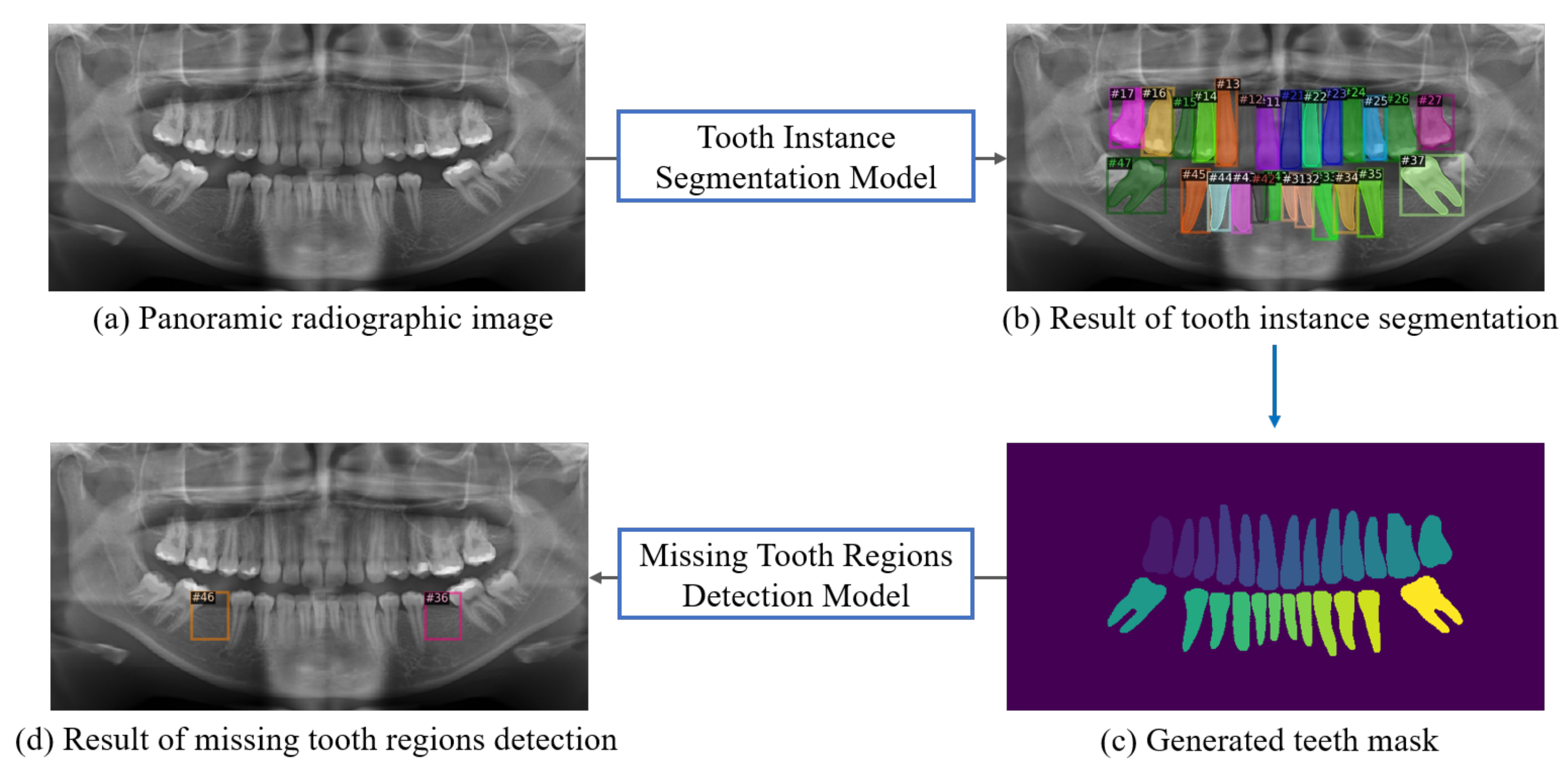 Figure 10 From Teeth Segmentation Of Dental Periapica