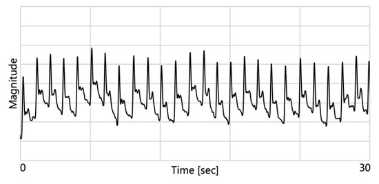 Blood Pressure Estimation by Photoplethysmogram Decomposition into ...