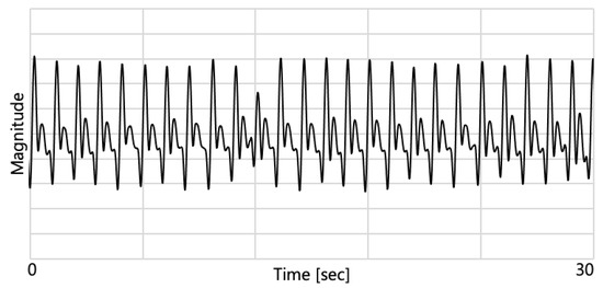 Blood Pressure Estimation by Photoplethysmogram Decomposition into ...