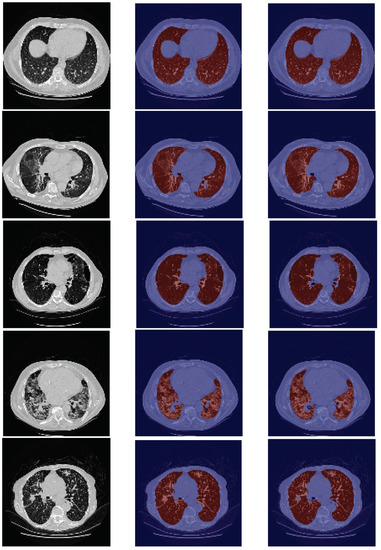 Lung Segmentation in CT Images: A Residual U-Net Approach on a Cross ...