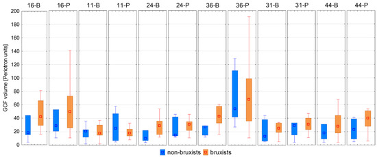 Bruxism Influence on Volume and Interleukin-1β Concentration of ...