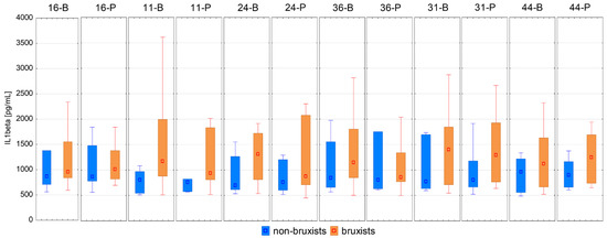 Bruxism Influence on Volume and Interleukin-1β Concentration of ...