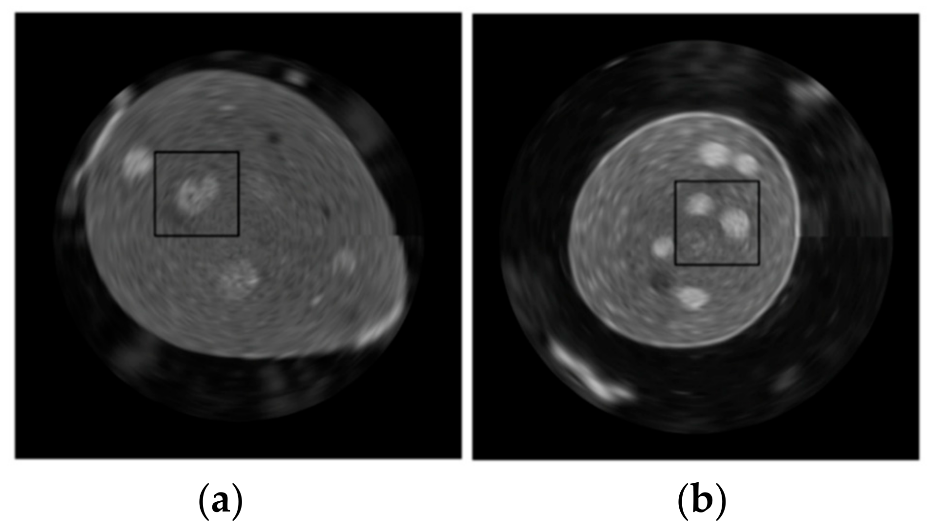 Different Types of Ultrasound Probes Usage for Multi-Angle Conventional ...