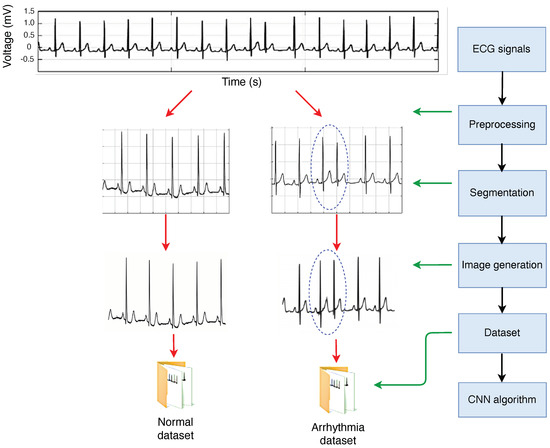 Energy Efficient Framework for a AIoT Cardiac Arrhythmia Detection System Wearable during Sport
