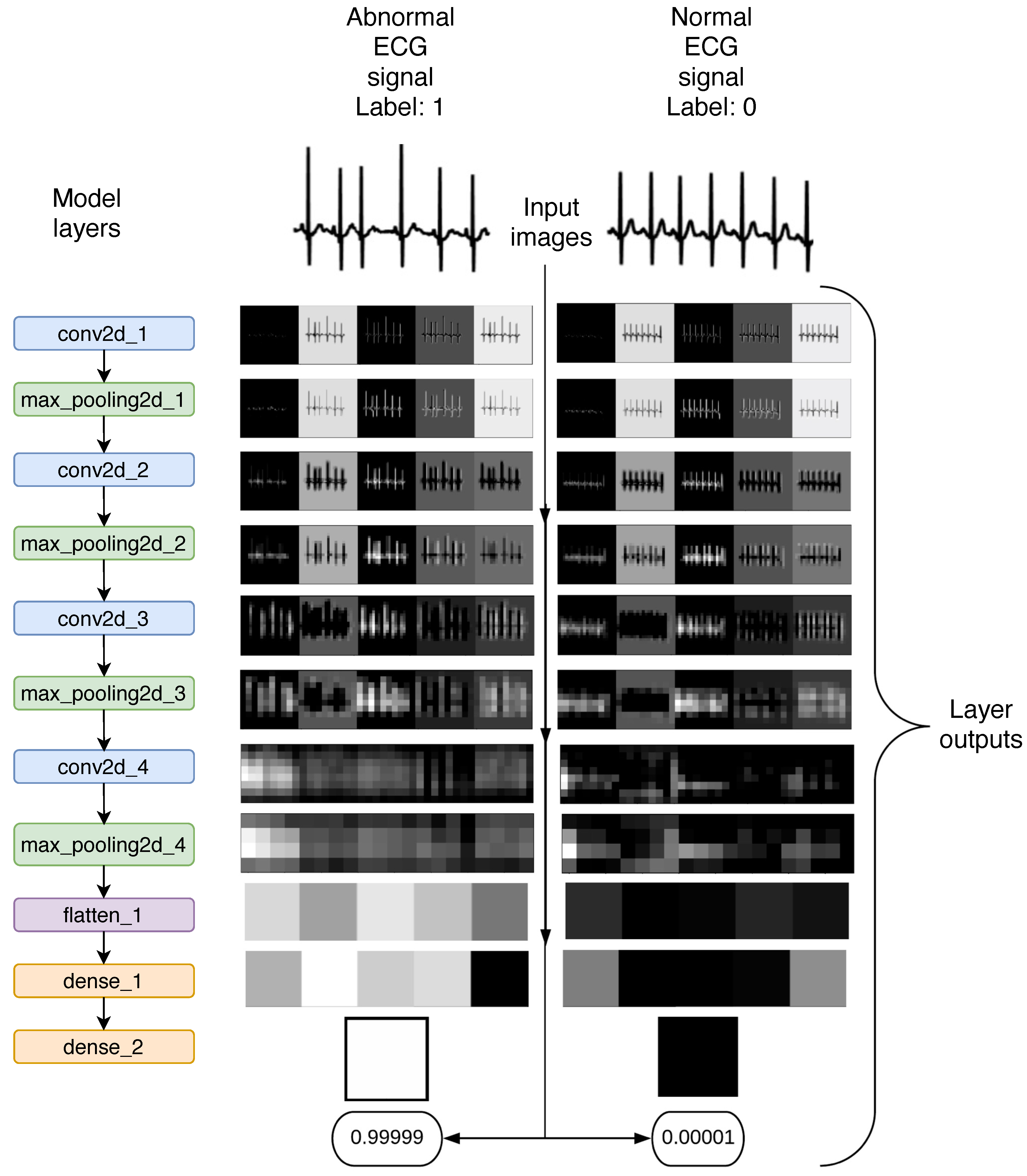 Energy Efficient Framework for a AIoT Cardiac Arrhythmia Detection ...