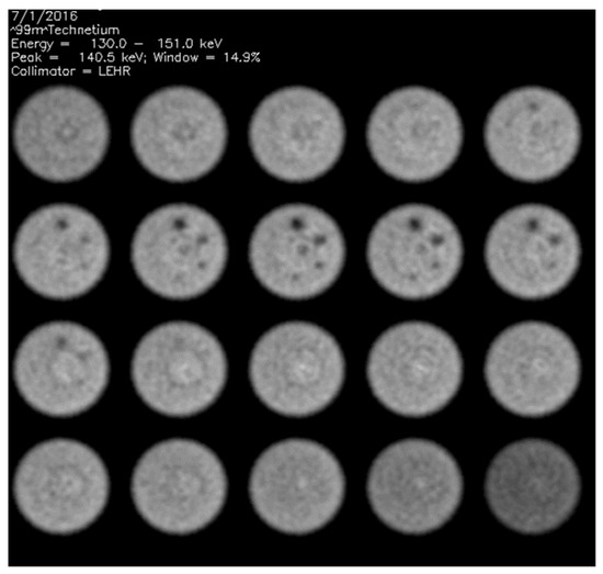 Applied Sciences | Free Full-Text | Quantification of SPECT Concentric ...