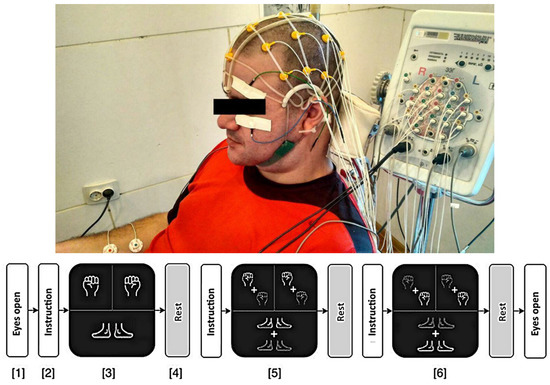 Discriminative Frequencies and Temporal EEG Segmentation in the Motor ...