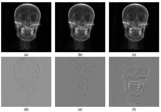 2D/3D Multimode Medical Image Registration Based on Normalized Cross ...