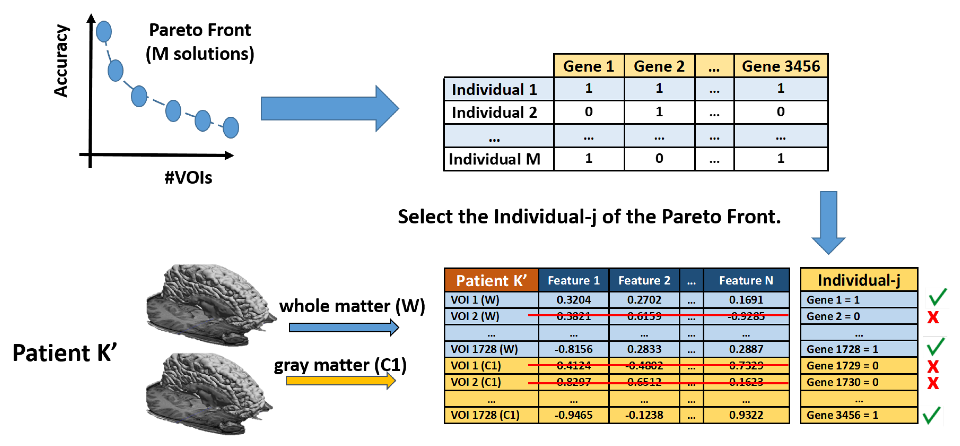 Multi-Class Classifier in Parkinson’s Disease Using an Evolutionary ...