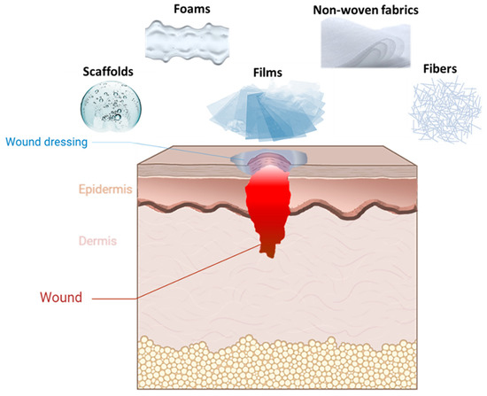 Hyaluronic Acid-Based Wound Dressing with Antimicrobial Properties for ...