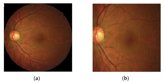 A Deep Learning Ensemble Method to Visual Acuity Measurement Using ...