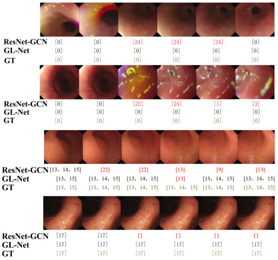 Real-Time Multi-Label Upper Gastrointestinal Anatomy Recognition from ...