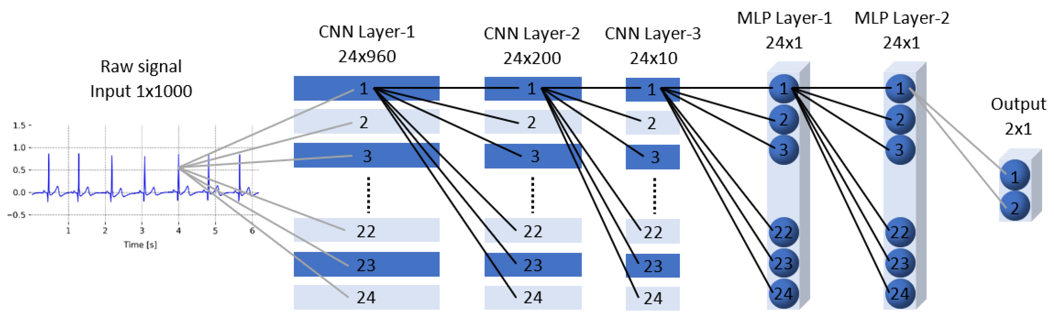 Semantic Segmentation Of 12 Lead Ecg Using 1d Residual U Net With Squeeze Excitation Blocks