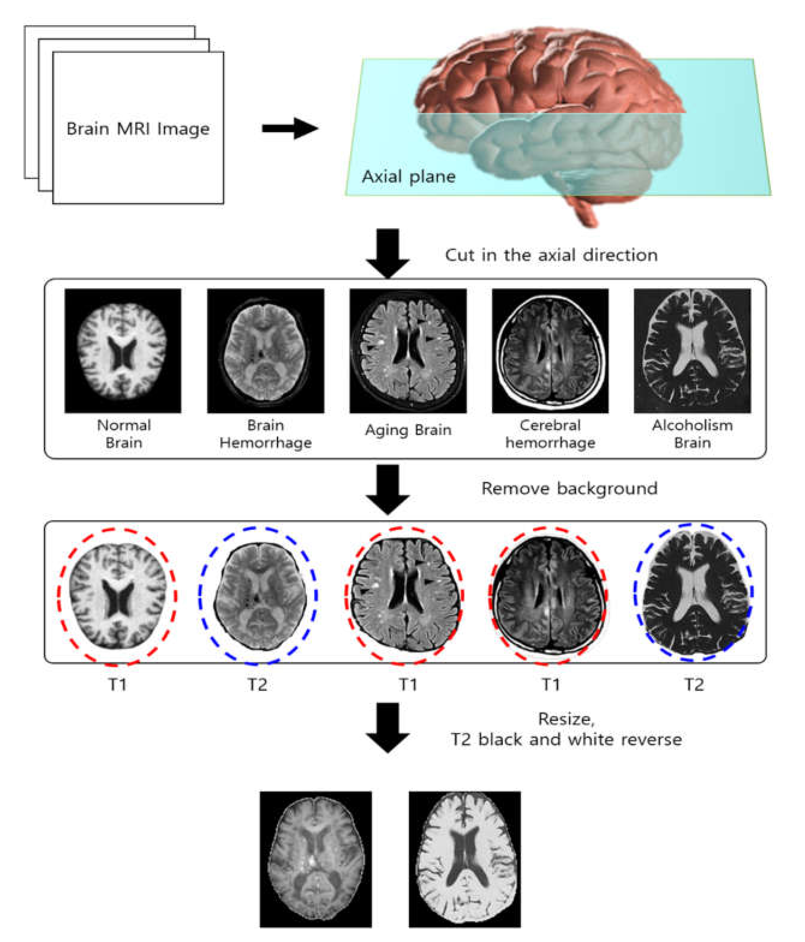 Applied Sciences | Free Full-Text | Dementia Prediction Support Model ...