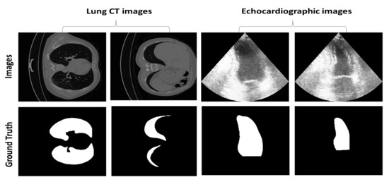 MDA-Unet: A Multi-Scale Dilated Attention U-Net for Medical Image ...