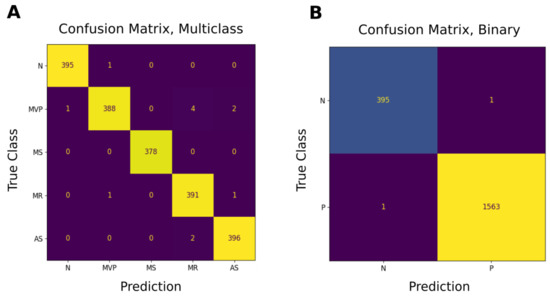 Deep Learning Algorithm for Heart Valve Diseases Assisted Diagnosis