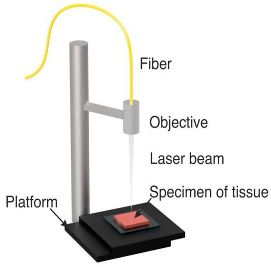 Ex Vivo Exposure to Soft Biological Tissues by the 2-μm All-Fiber ...