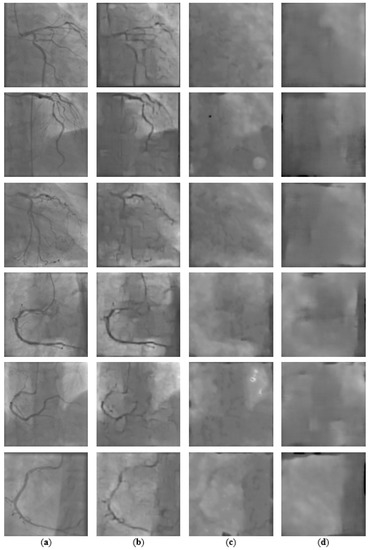 Obfuscation Algorithm for Privacy-Preserving Deep Learning-Based ...
