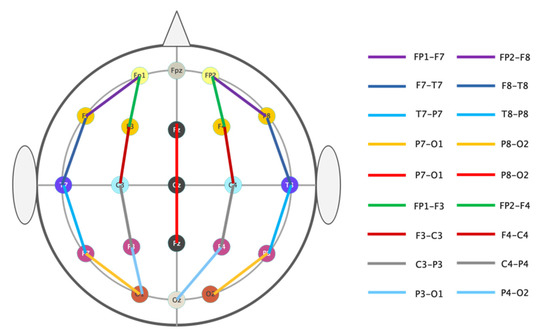 Seizure Prediction Based on Transformer Using Scalp Electroencephalogram