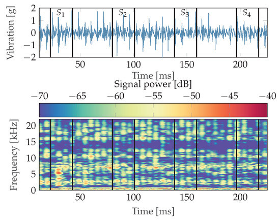 Investigations into the Recognisability of Gear Damage Sizes in ...