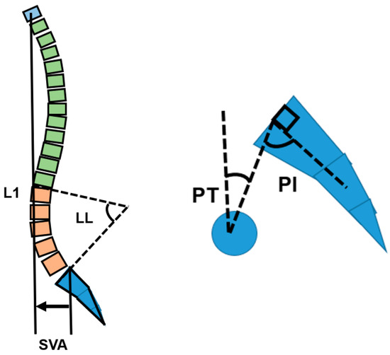 Chronological Evaluation of Gait Ability and Posture Balance after ...