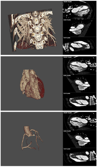 Applied Sciences | Free Full-Text | Autostereoscopic 3D Display System ...