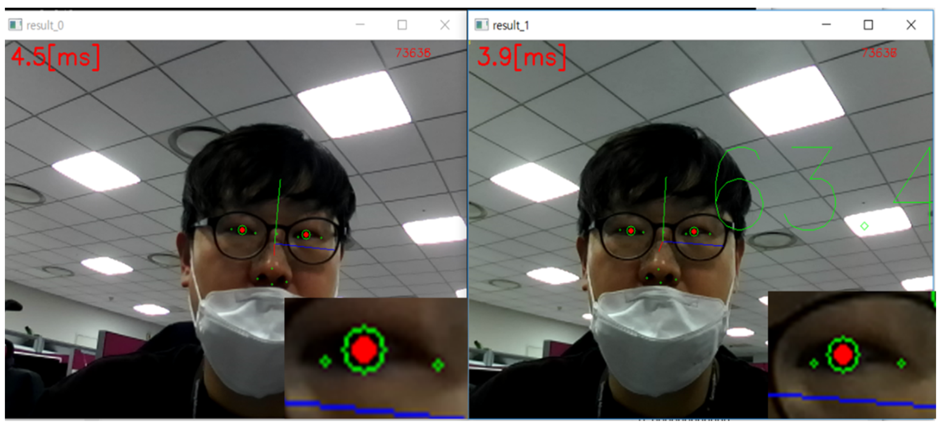 Applied Sciences | Free Full-Text | Autostereoscopic 3D Display System for 3D Medical Images