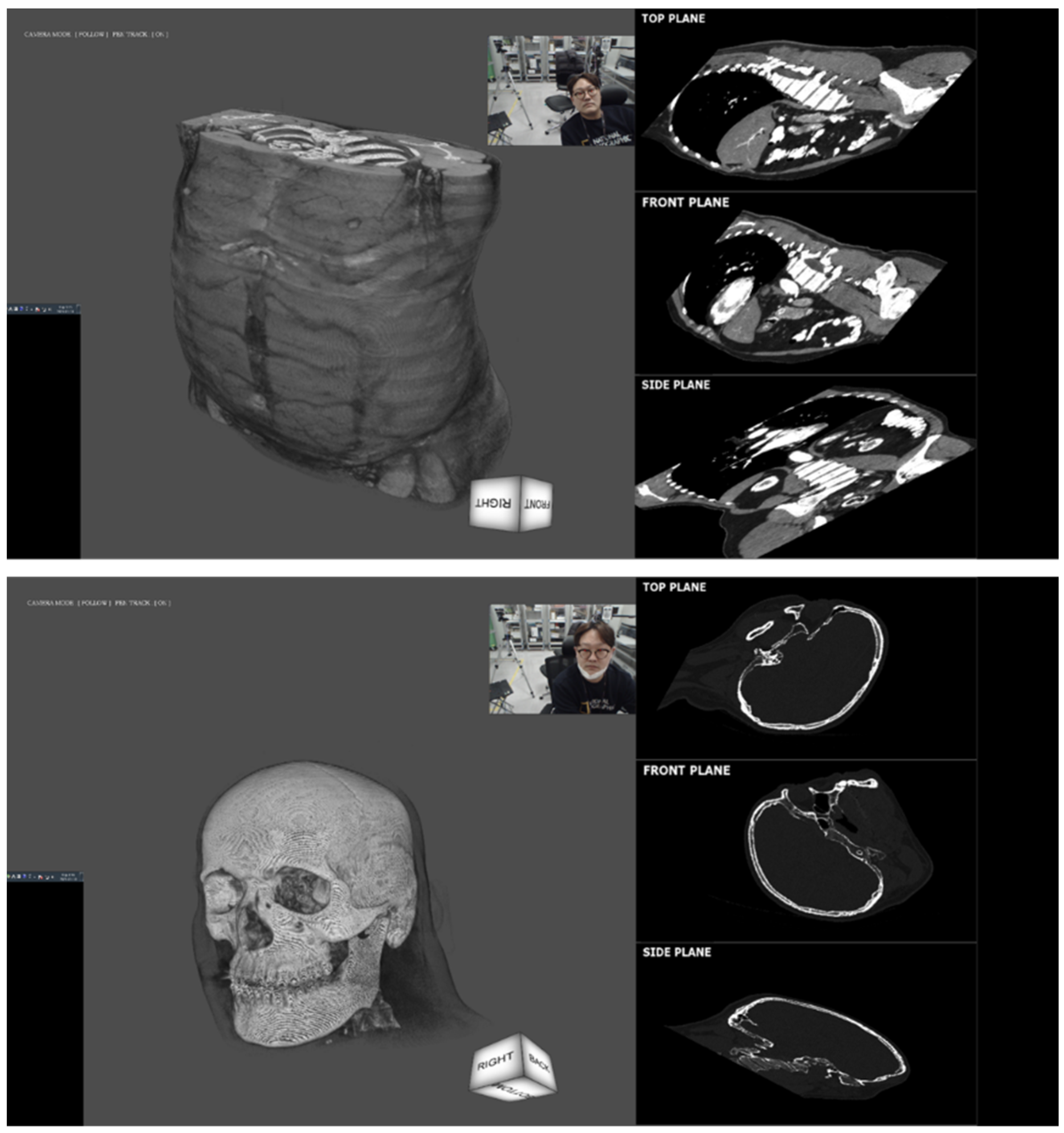 Applied Sciences | Free Full-Text | Autostereoscopic 3D Display System for 3D Medical Images
