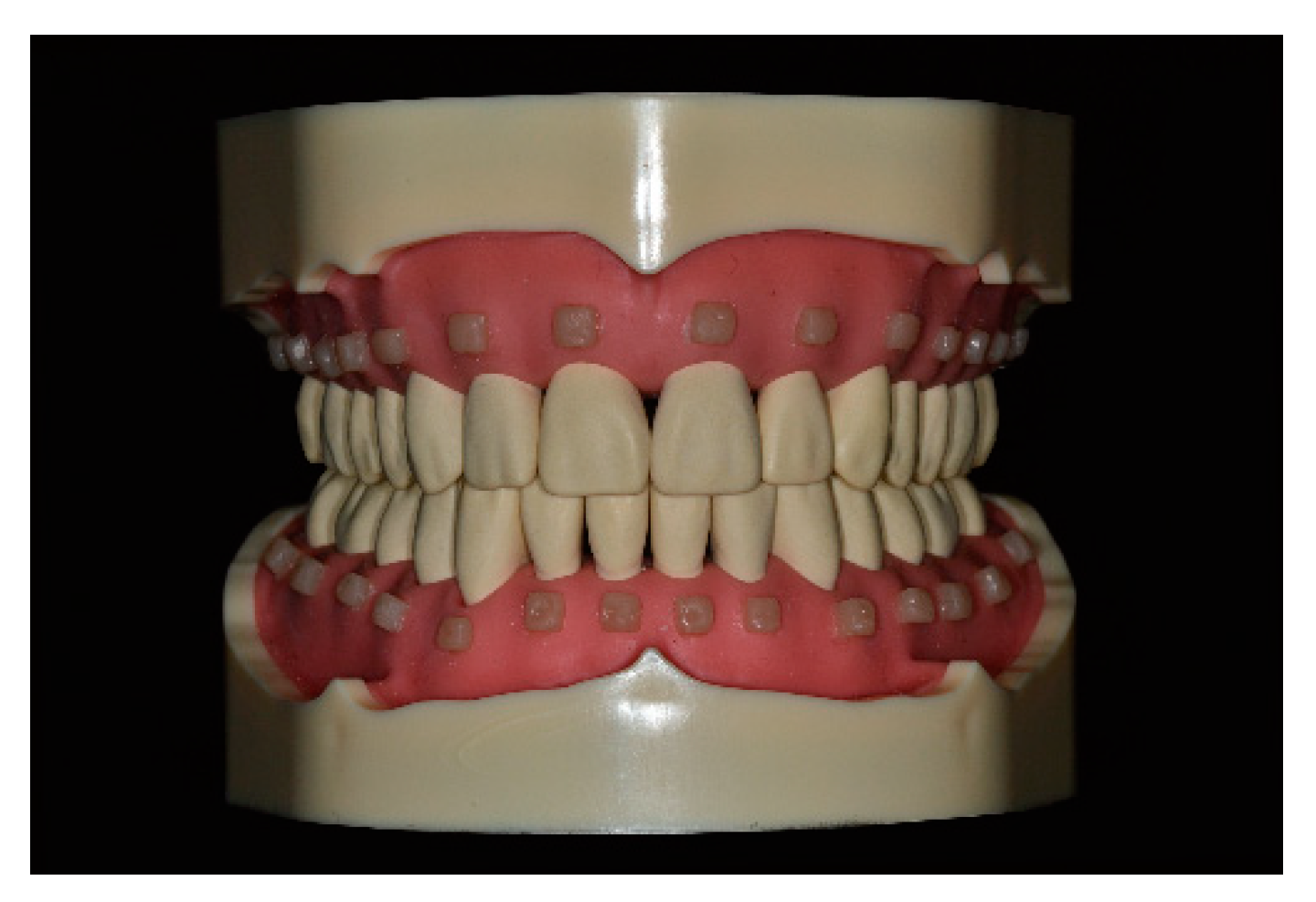 Accuracy of Additively Manufactured Dental Casts Compared with That of ...