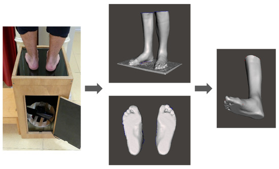 Development of a Novel Passive-Dynamic Custom AFO for Drop-Foot ...