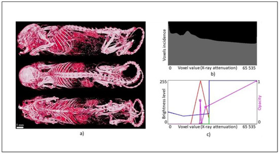 Medical Image Analysis