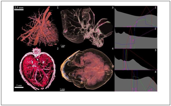 Medical Image Analysis