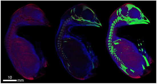 Medical Image Analysis