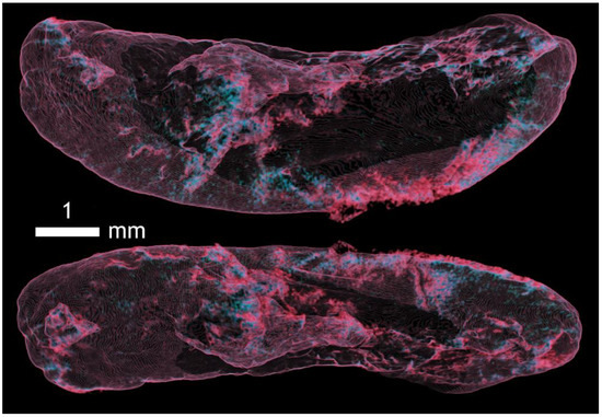 Medical Image Analysis