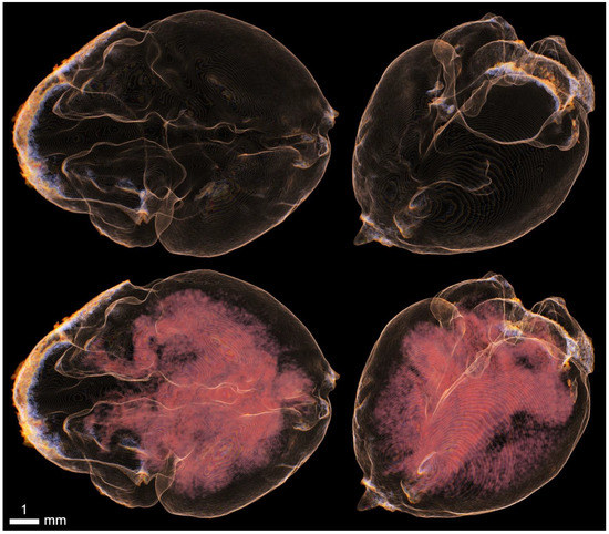 Medical Image Analysis
