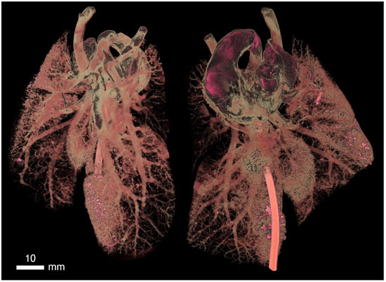 Medical Image Analysis