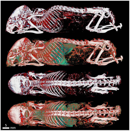 Medical Image Analysis