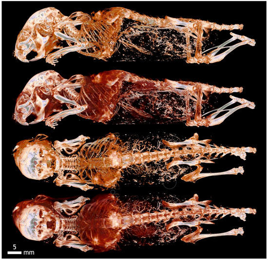 Medical Image Analysis
