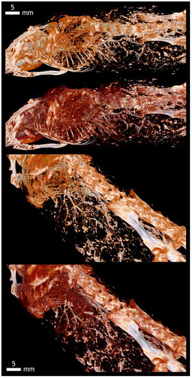 Medical Image Analysis