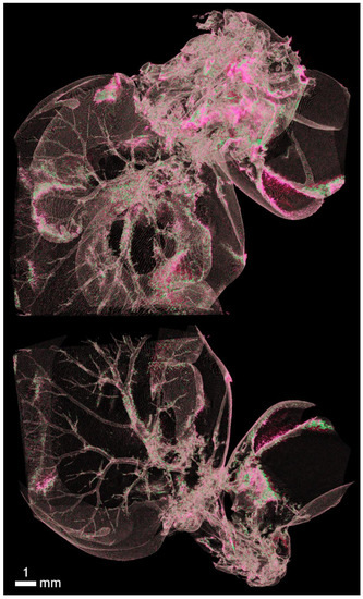 Medical Image Analysis