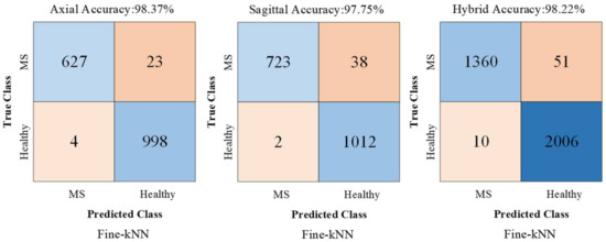 An Accurate Multiple Sclerosis Detection Model Based on Exemplar ...