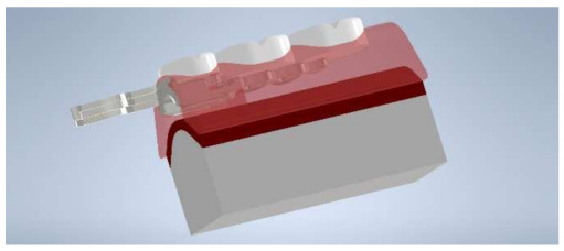 Finite Element Comparative Analysis of Von Mises Stress Levels in ...