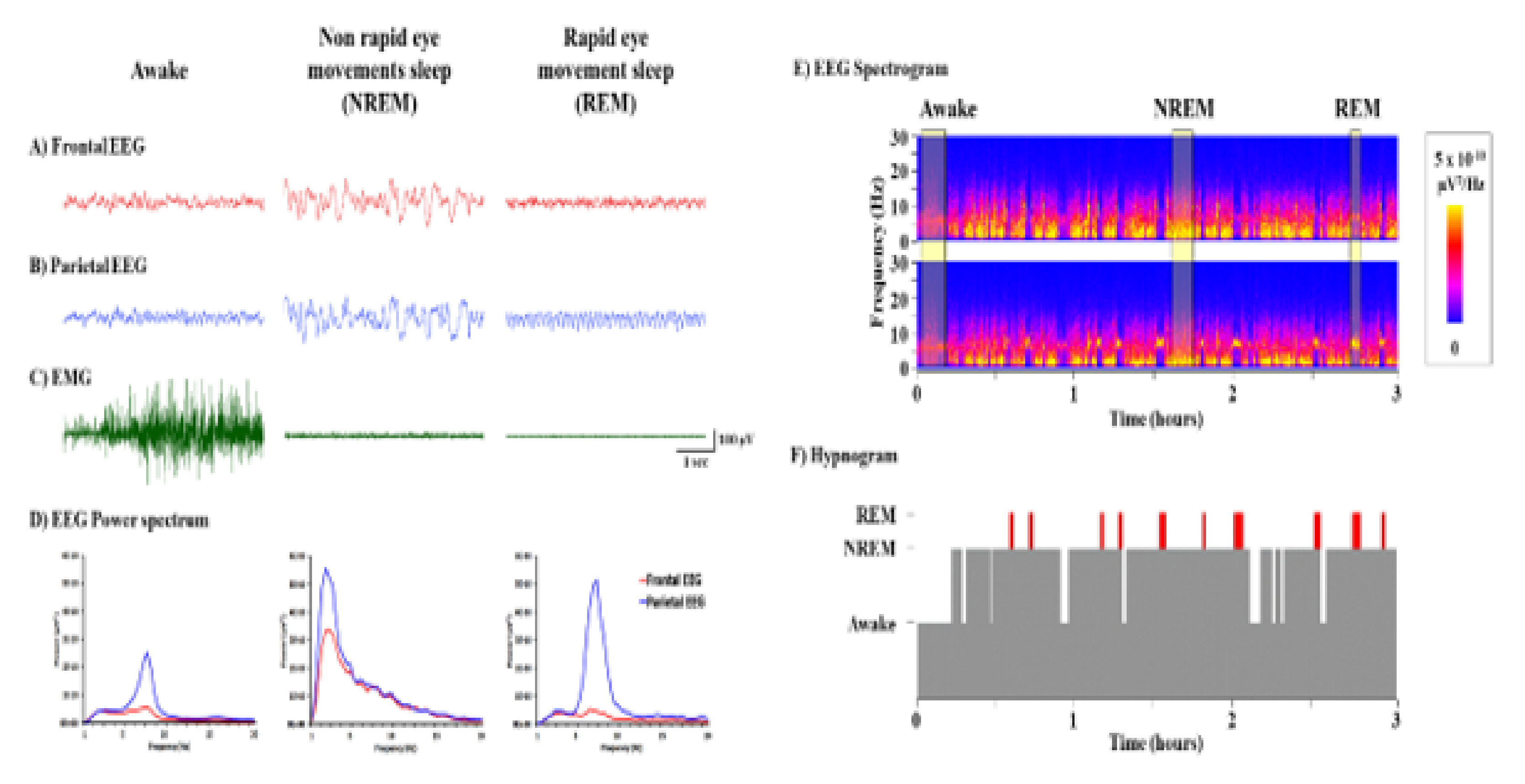Employing a Long-Short-Term Memory Neural Network to Improve Automatic ...