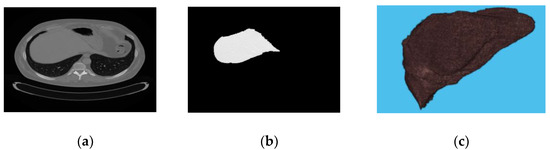 LiverNet: Diagnosis of Liver Tumors in Human CT Images
