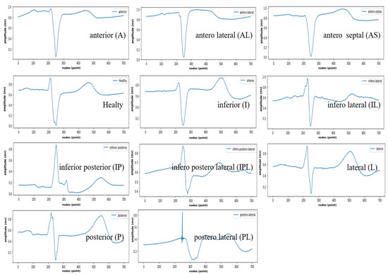 Applied Sciences | Free Full-Text | Automatic Classification of 15 Leads ECG Signal of ...