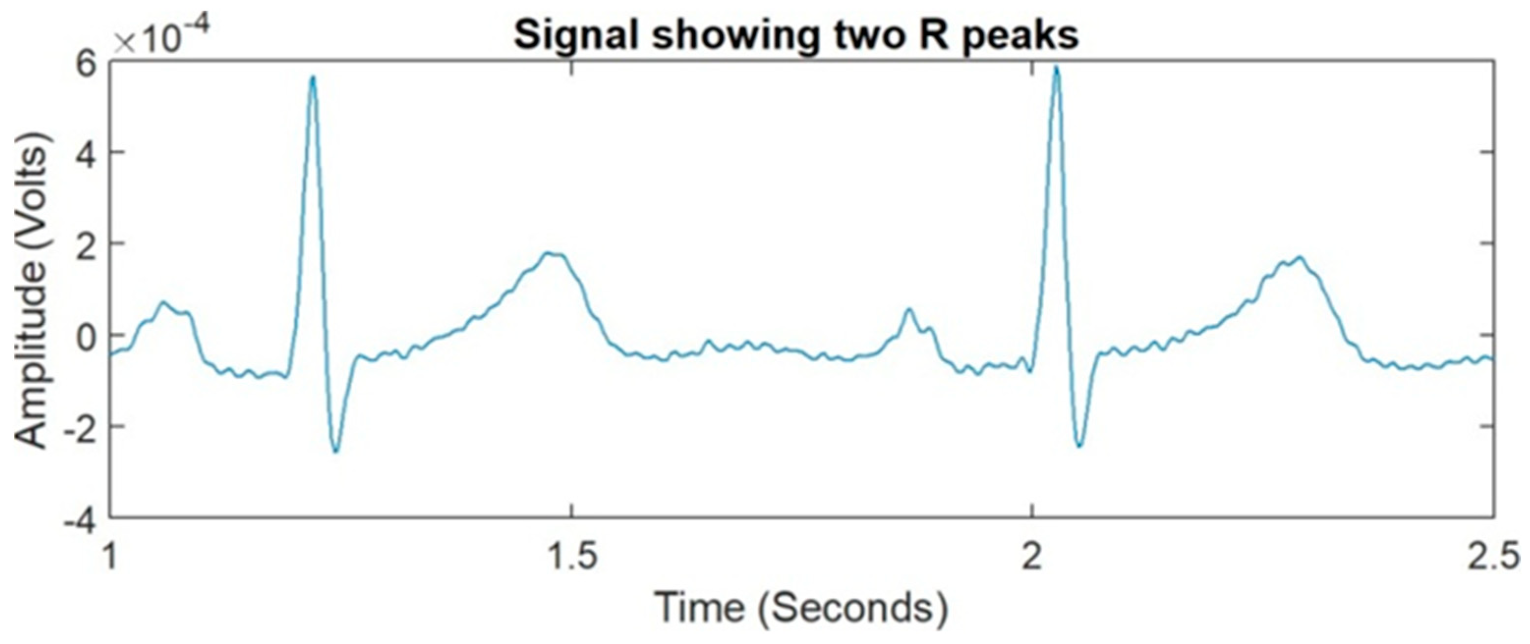Complexity Analysis in the PR, QT, RR and ST Segments of ECG for Early ...