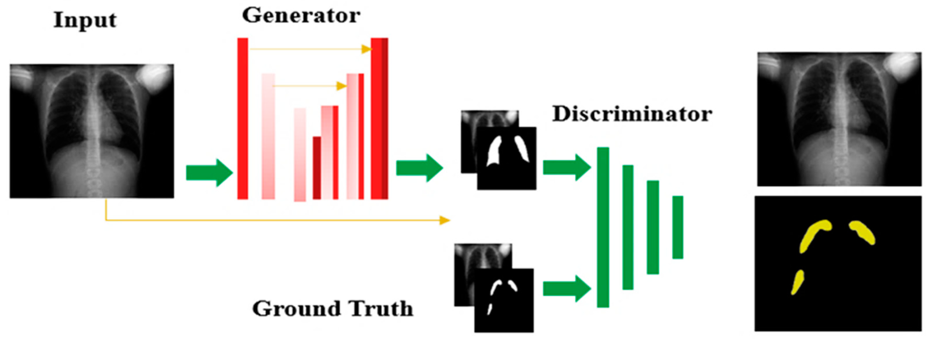 Applied Sciences | Free Full-Text | Lung’s Segmentation Using Context ...